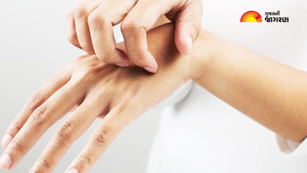 Hand Itching: જો તમને તમારા હાથ પર બળતરા અને ખંજવાળ આવી રહી છે, તો ...