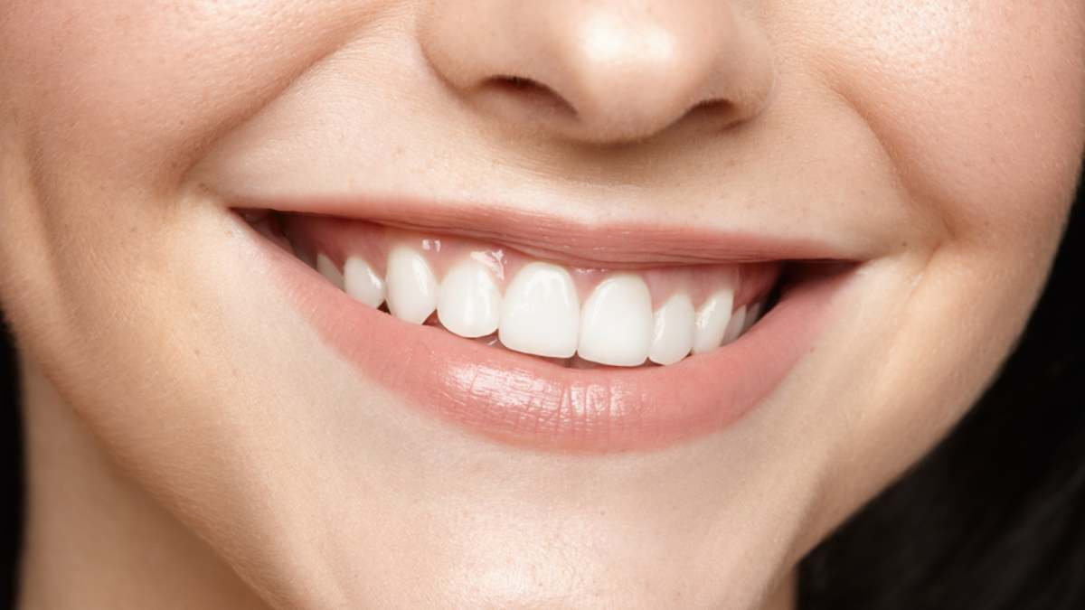 દાંત હંમેશા રહેશે સ્વસ્થ, અપનાવો આ 7 સારી આદતો- Teeth will always be ...