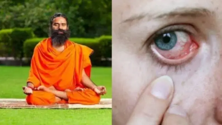 Baba Ramdev Health Tips: Dry Eyesની સમસ્યાથી પરેશાન છો? ફોલો કરો બાબા ...